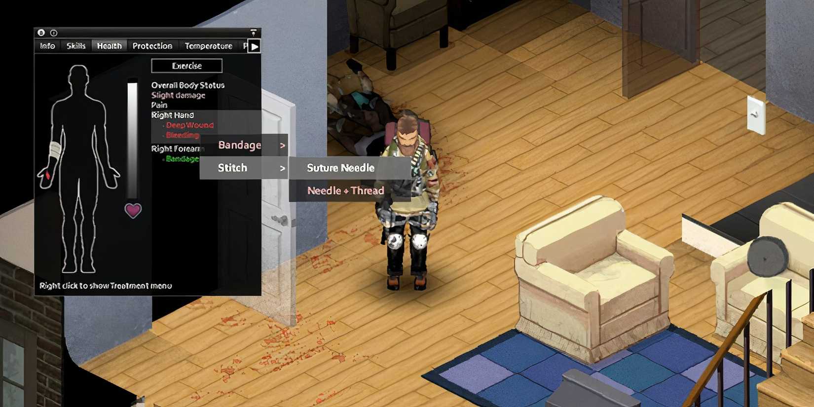 The Best Items To Always Have On-Hand In Project Zomboid