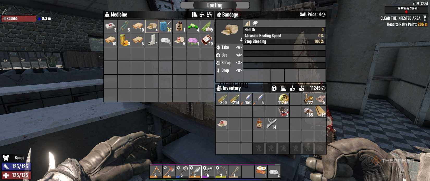 How To Heal Sprains And Broken Legs In 7DTD