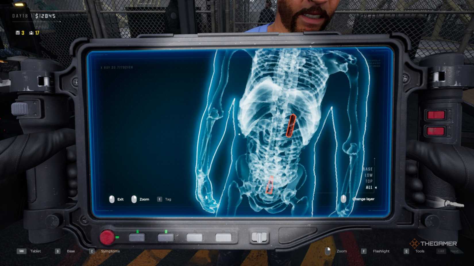 Which Contraband Items Are Safe, And Which You Should Take In ...